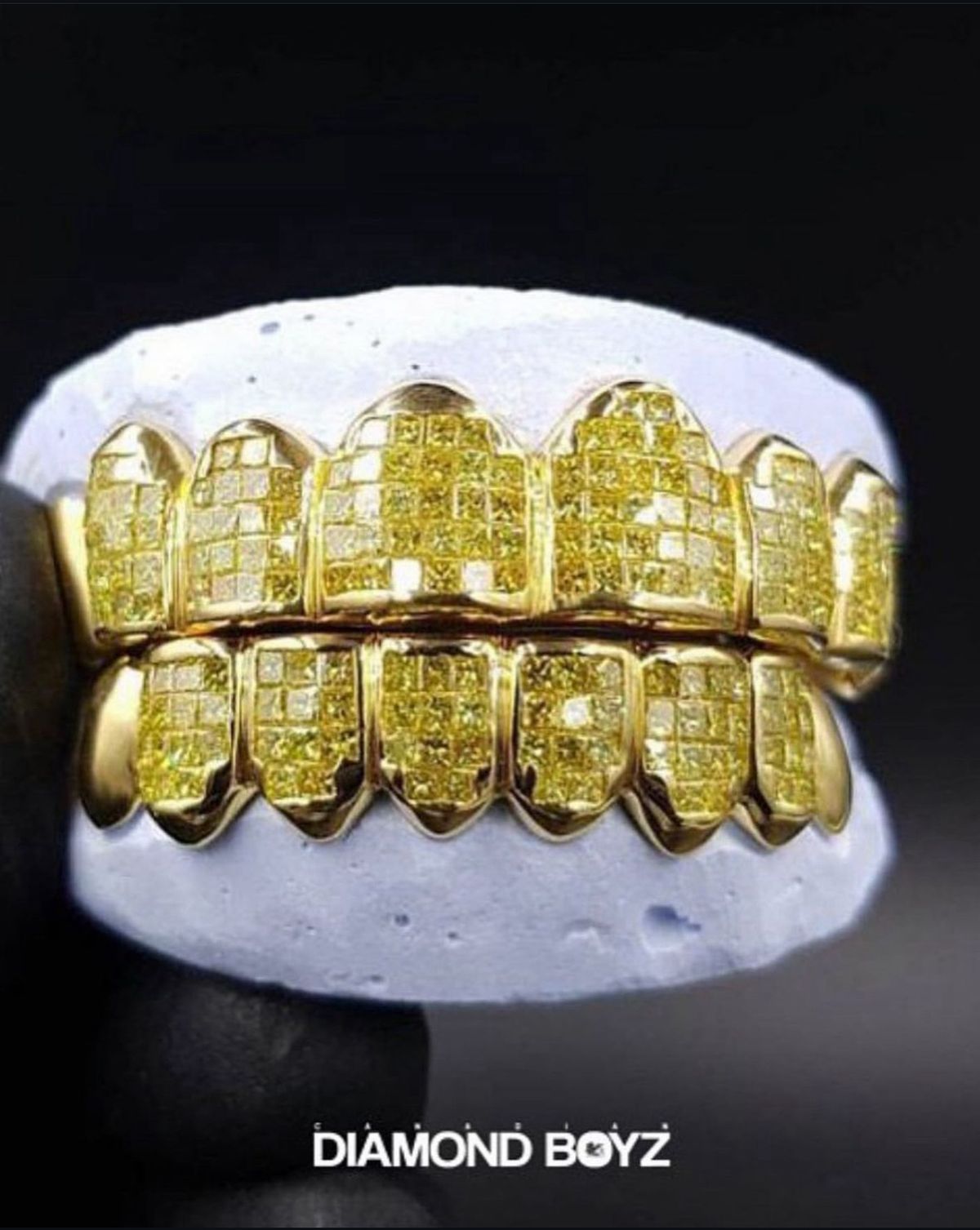 How to Get Custom Grillz: Process, Options, and What to Expect